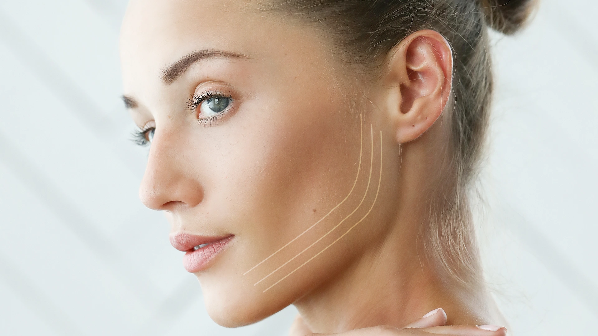 Fios de pdo - Clinica Marina Hayashida